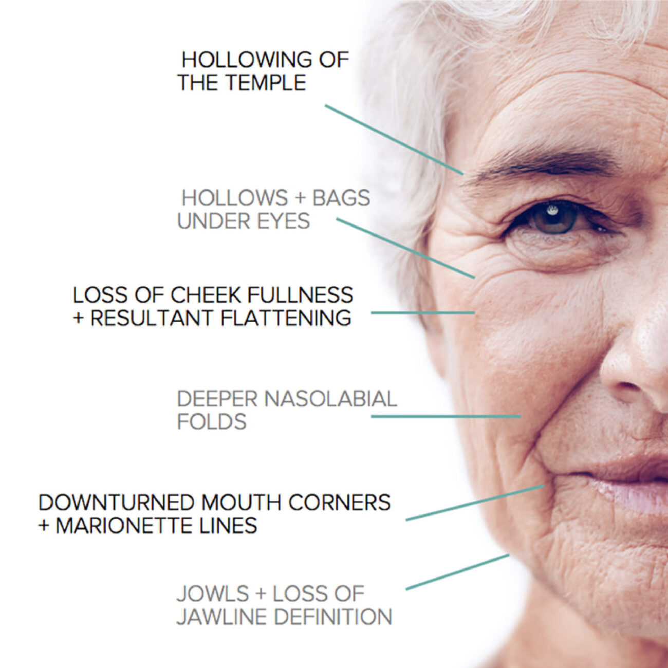 Volume Restoration | Facial Restoration Treatment | Dr Sin Yong
